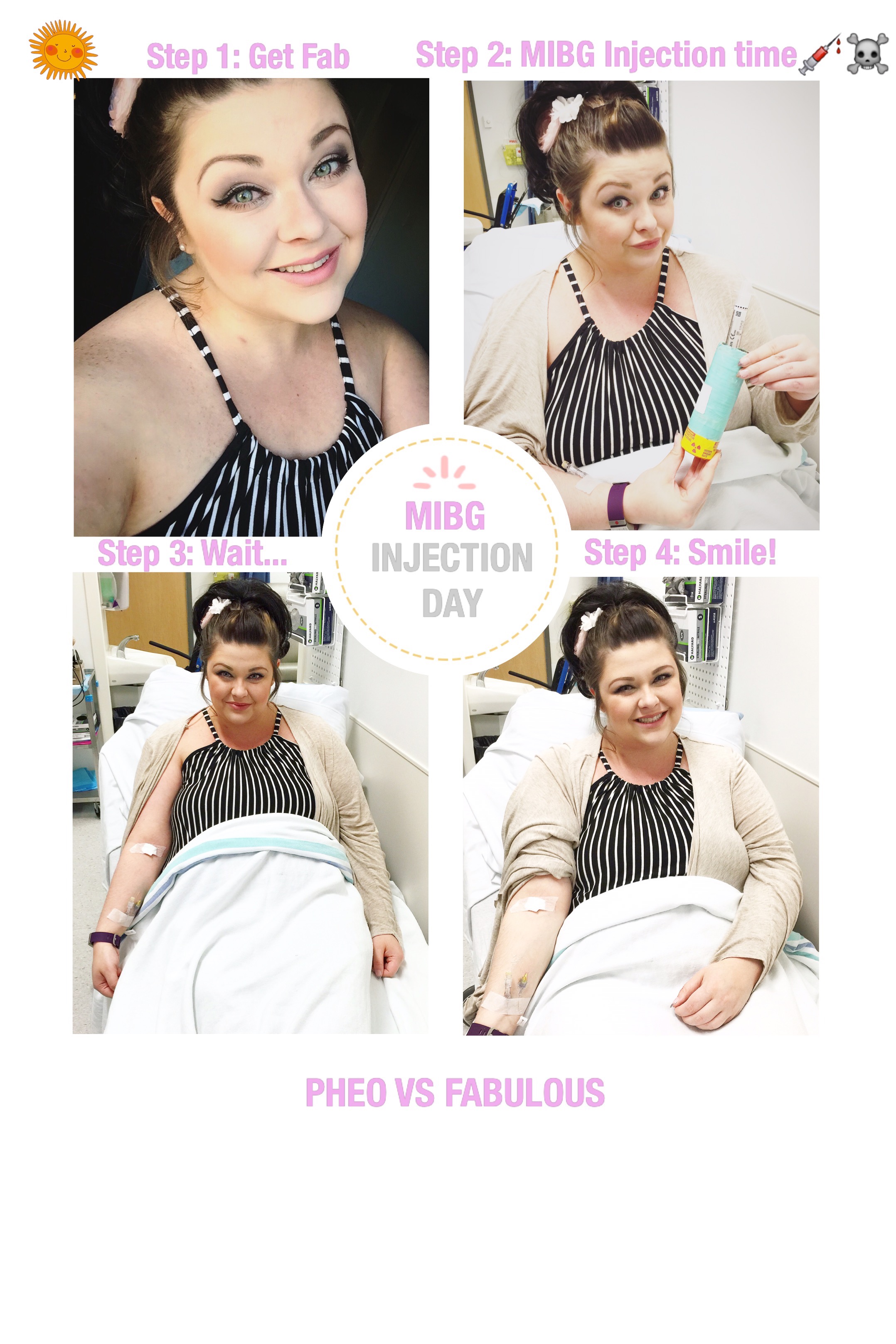 MIBG & Iodine Allergy – Pheo vs Fabulous